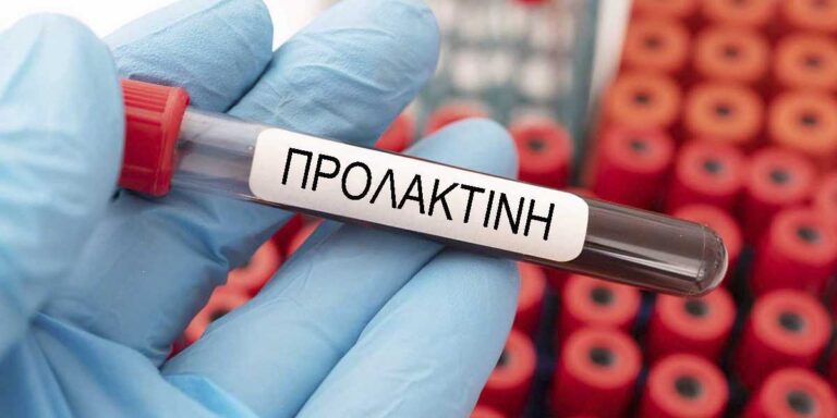 Προλακτίνη και καρκίνος - Αριστοτέλης Βάθης MD MSc ECP | Ψυχίατρος ...